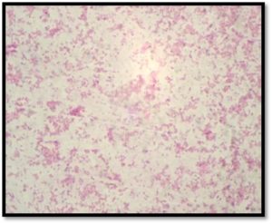 Isolation, Identification and Molecular Characterization of Brucella ...