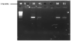 Molecular Identification of TEM and SHV Genes in Extended Spectrum Beta ...