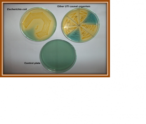 Comparative Study Between Different Types of Media used for the ...