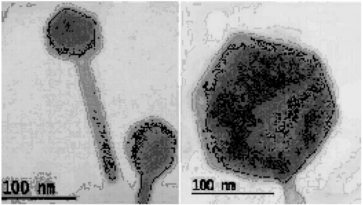 Isolation and Characterization of Lytic Coliphages from Sewage Water ...