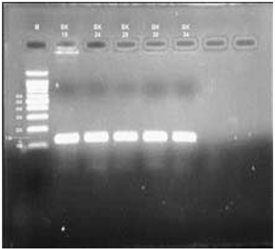 Isolation and Identification of Common Mastitis Causing Pathogens from ...