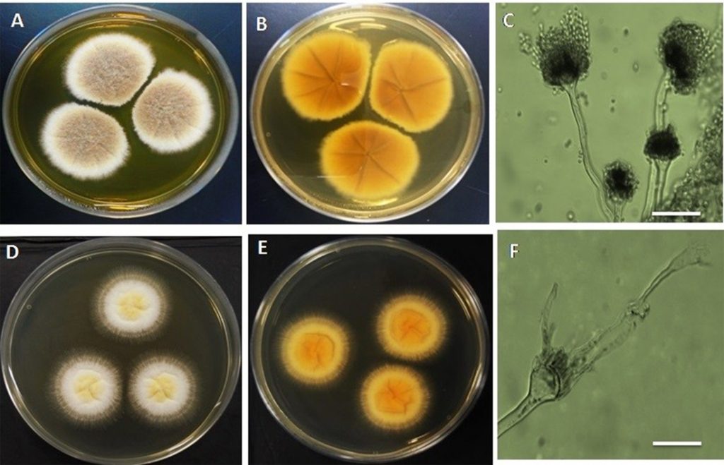 Morphological Changes of Conidiogenesis in Two Aspergillus Species ...