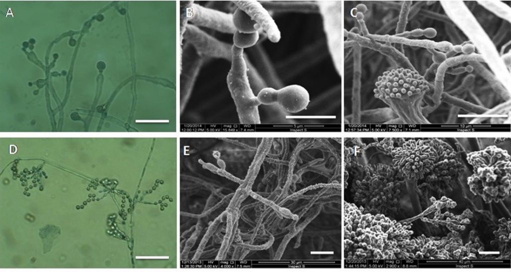 Morphological Changes of Conidiogenesis in Two Aspergillus Species ...
