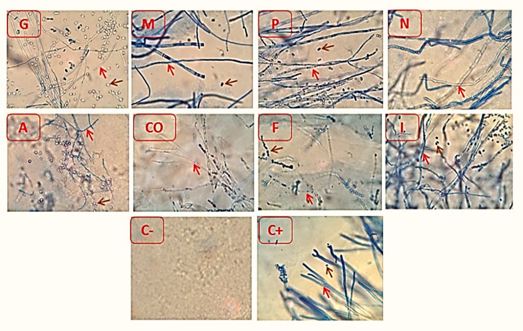 In vitro Study of Topical Antiseptics Used to Treat Mycological Gill ...