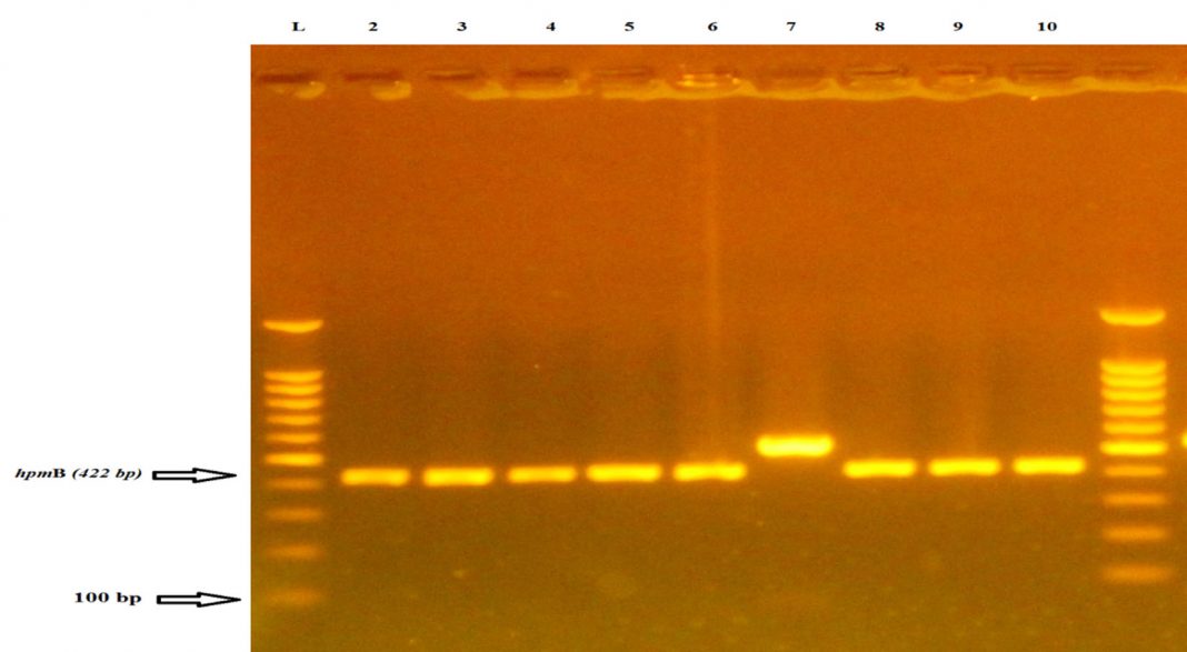The Sequencing of hpmB Gene in Proteus mirabilis Among UTIs Patients ...