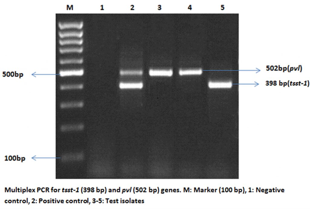 Association of tsst-1 and pvl with mecA Genes among Clinical ...