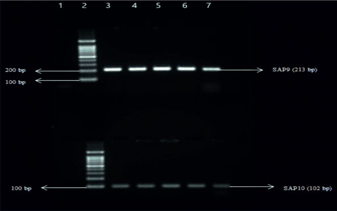 Genotypic Patterns of Secreted Aspartyl Proteinase Gene in Various ...