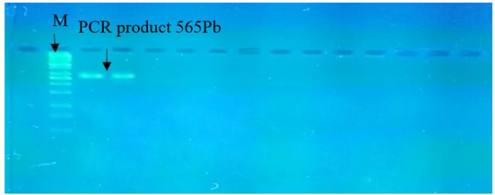 Characterization and Antagonistic Activity of New Causal Agent of Wilt Disease in Imperata ...