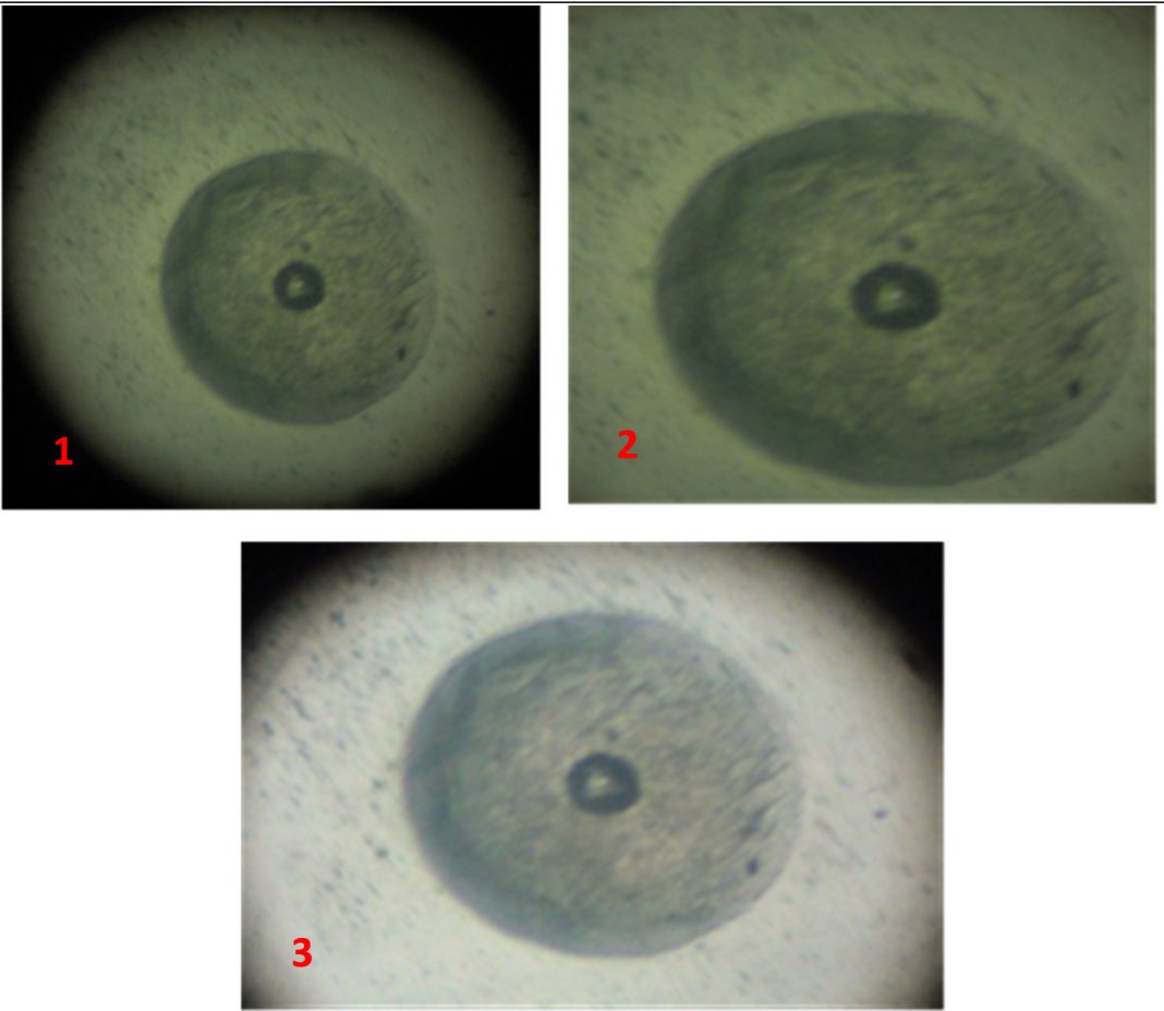 Diagnosis of Mycoplasma from Starlings Lungs - Journal of Pure and ...