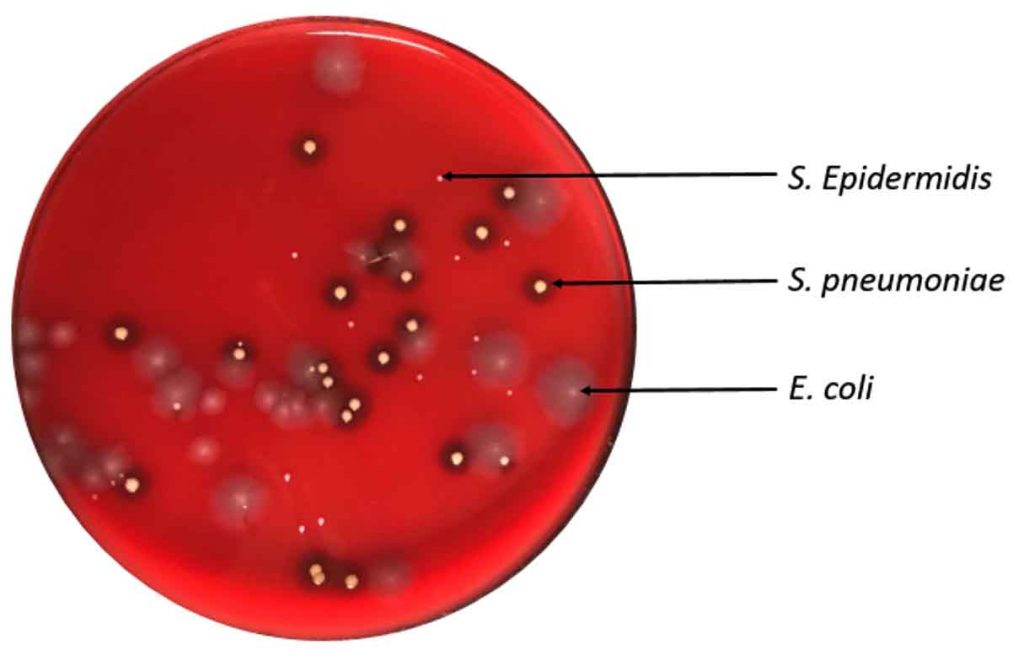A Sticking Point in Assessing Bacterial Contamination: Adhesive ...