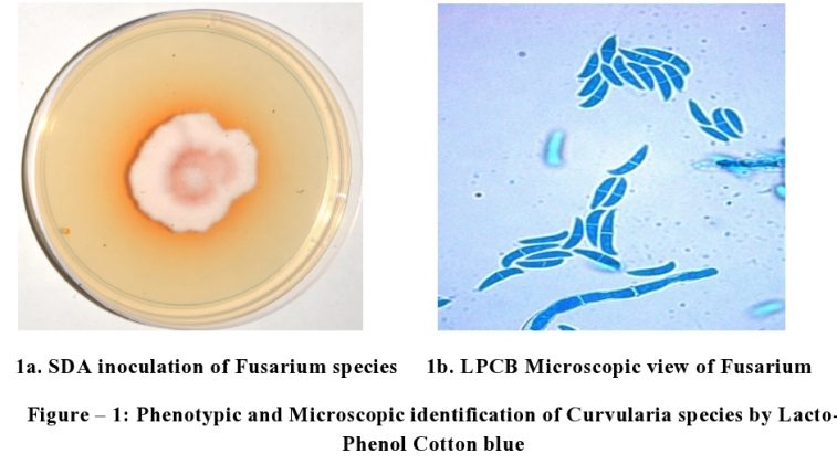 Microscopic Identification of Etiological Agents of Mycotic Keratitis ...