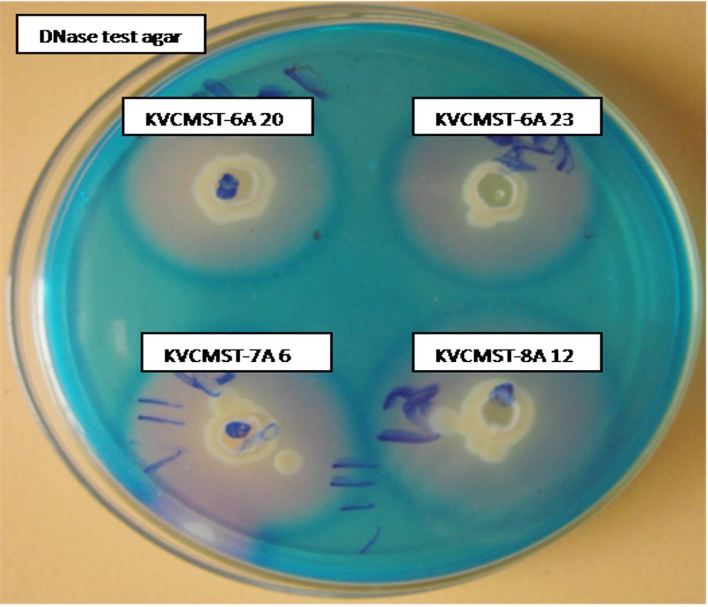 Isolation and Molecular Level Identification of DNase Producing ...