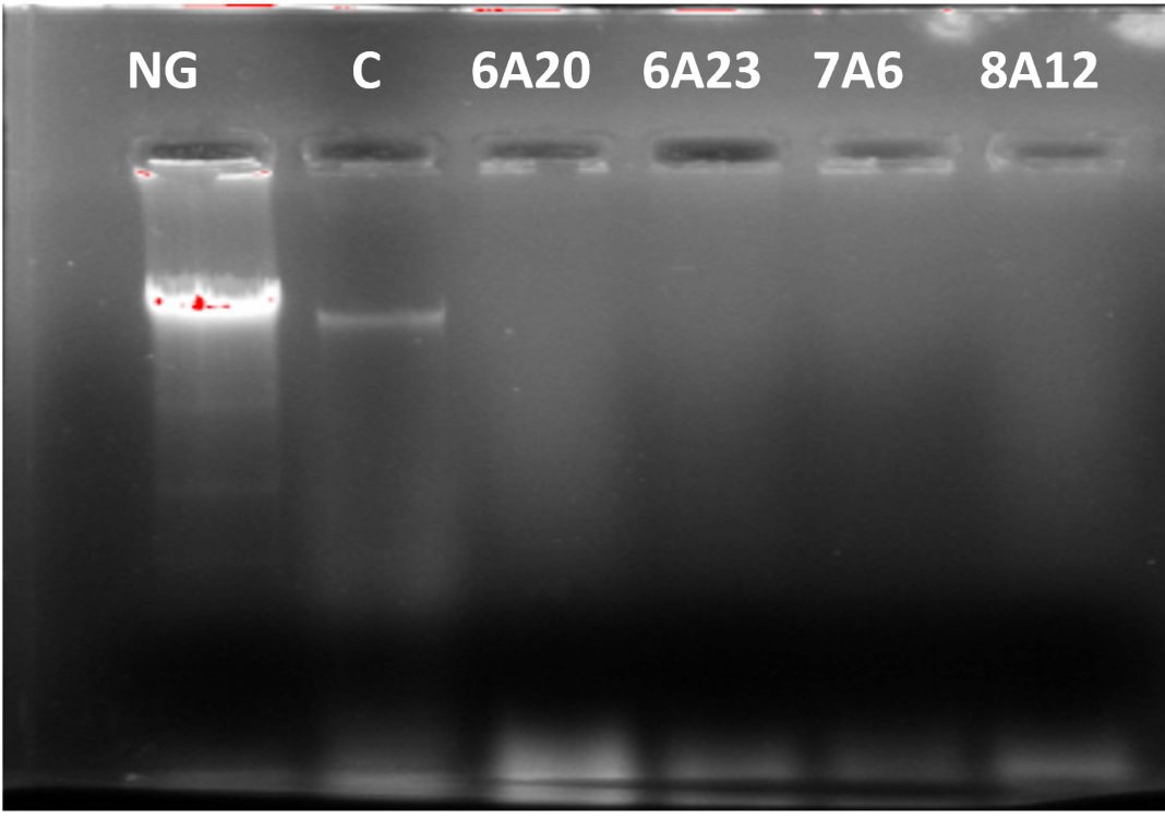 Isolation and Molecular Level Identification of DNase Producing ...