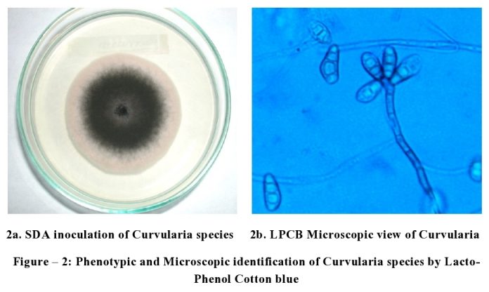 Microscopic Identification of Etiological Agents of Mycotic Keratitis ...