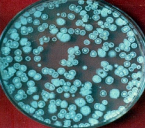 Isolation of Actinomycetes Strains and their Different Levels of ...