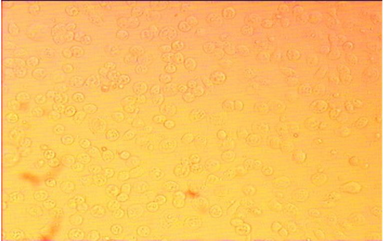 In vitro Evaluation of Antibacterial, Cytotoxic and Adherence Studies ...