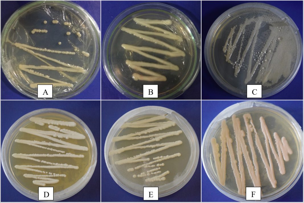Occurrence and Distribution of Cryptococcus Species in Environmental ...