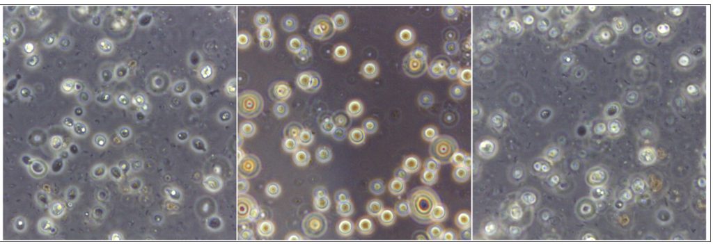 Occurrence and Distribution of Cryptococcus Species in Environmental ...