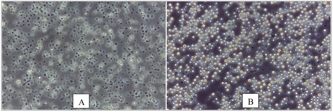 Occurrence and Distribution of Cryptococcus Species in Environmental ...