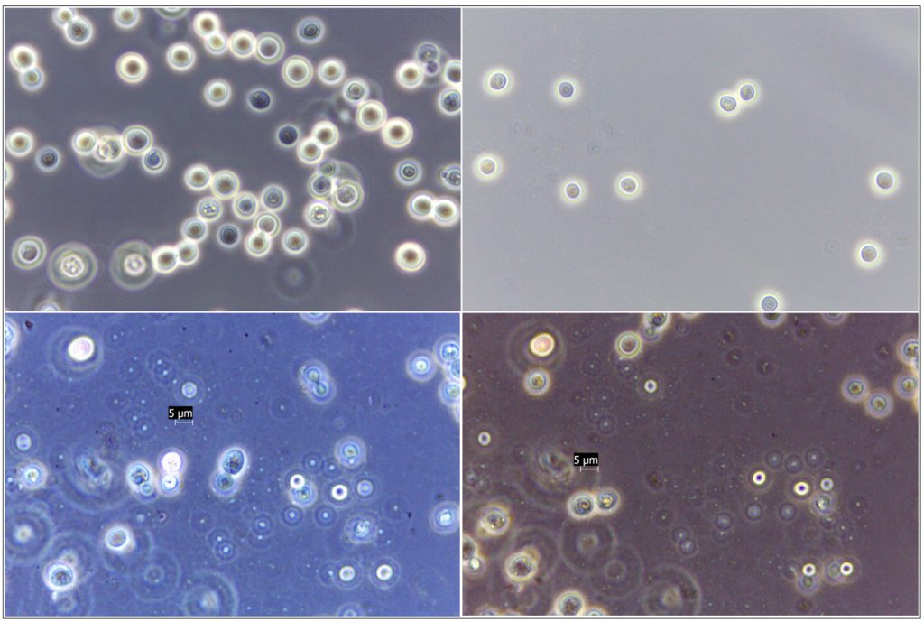 Occurrence and Distribution of Cryptococcus Species in Environmental ...