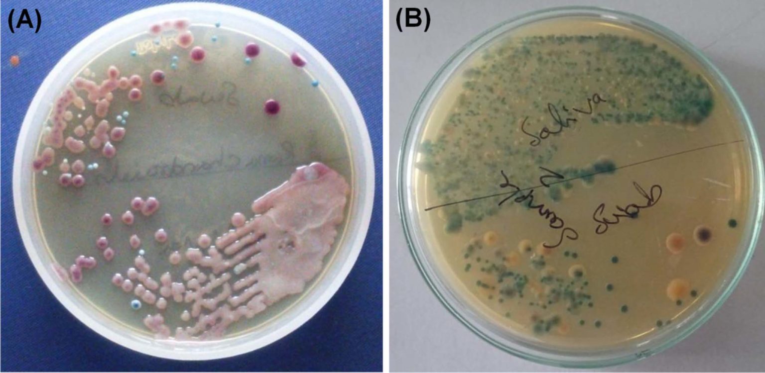 Prevalence of different fungal species in Saliva and Swab samples of ...