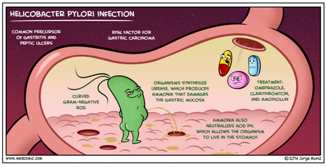Rheumatic Heart Disease And Its Association With H Pylori Infection