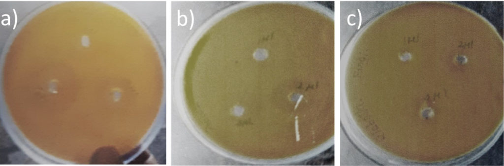 Extraction of Chitosan from Crab Shell and Fungi and Its Antibacterial ...
