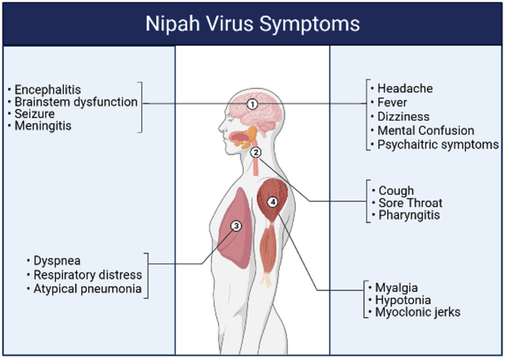 Nipah Virus Mystery: Insight into Transmission and Mechanism of Disease ...