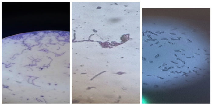 Screening and Isolation of Bacteria Producing Biosurfactants from Waste ...