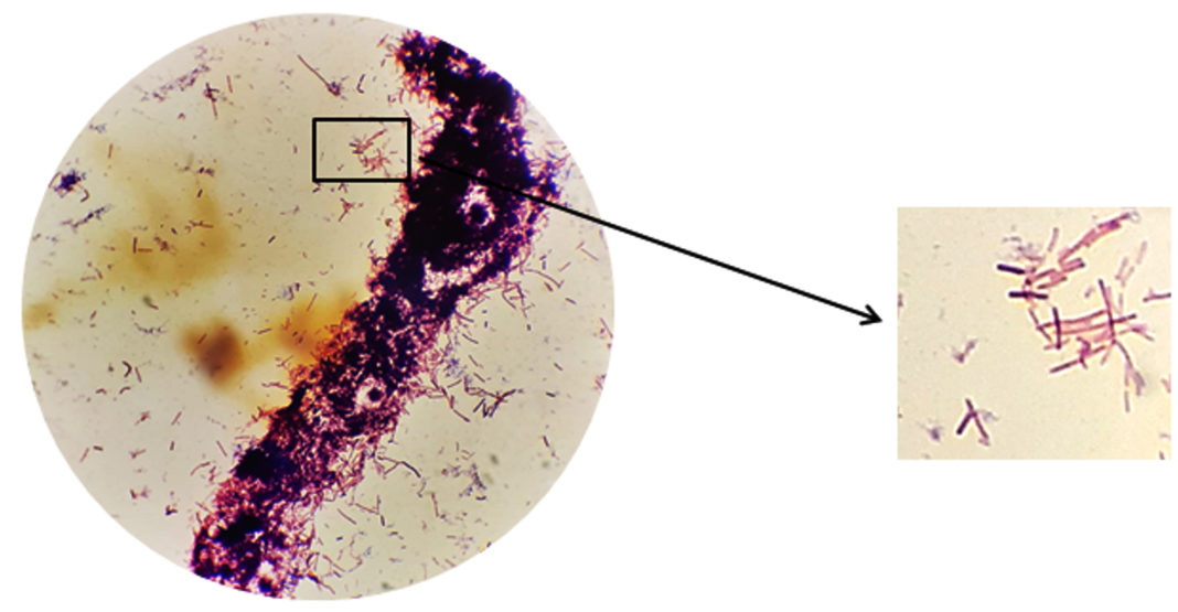 Isolation of Sponge Bacterial Symbionts from Kodingareng Keke Island ...