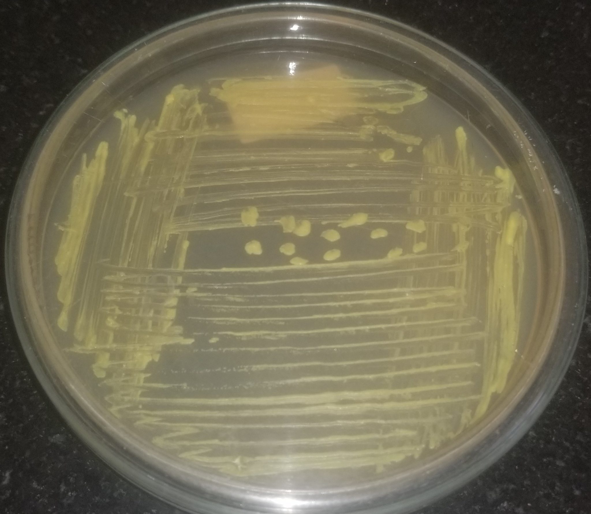 Isolation, Characterization, and Optimization Studies of Bacterial ...