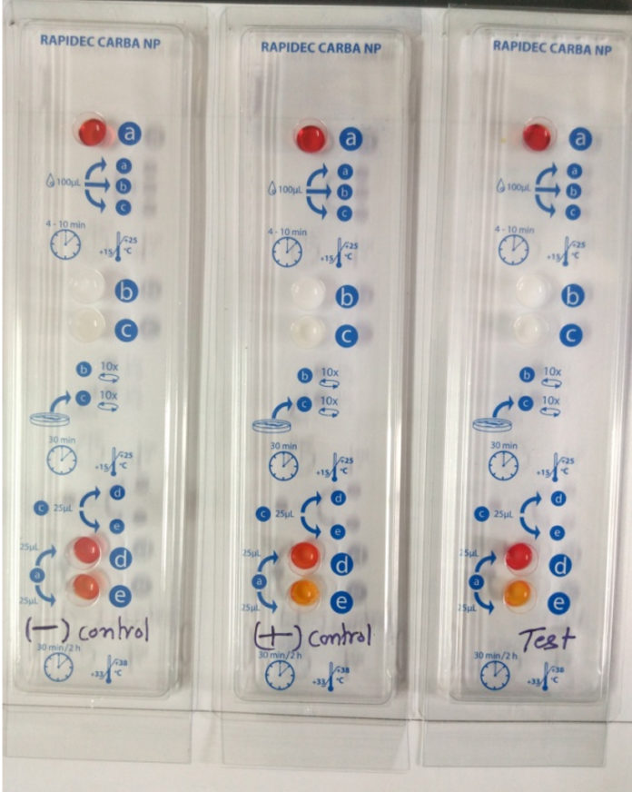 Detection of Carbapenem-resistant Enterobacteriaceae by Real-Time PCR ...