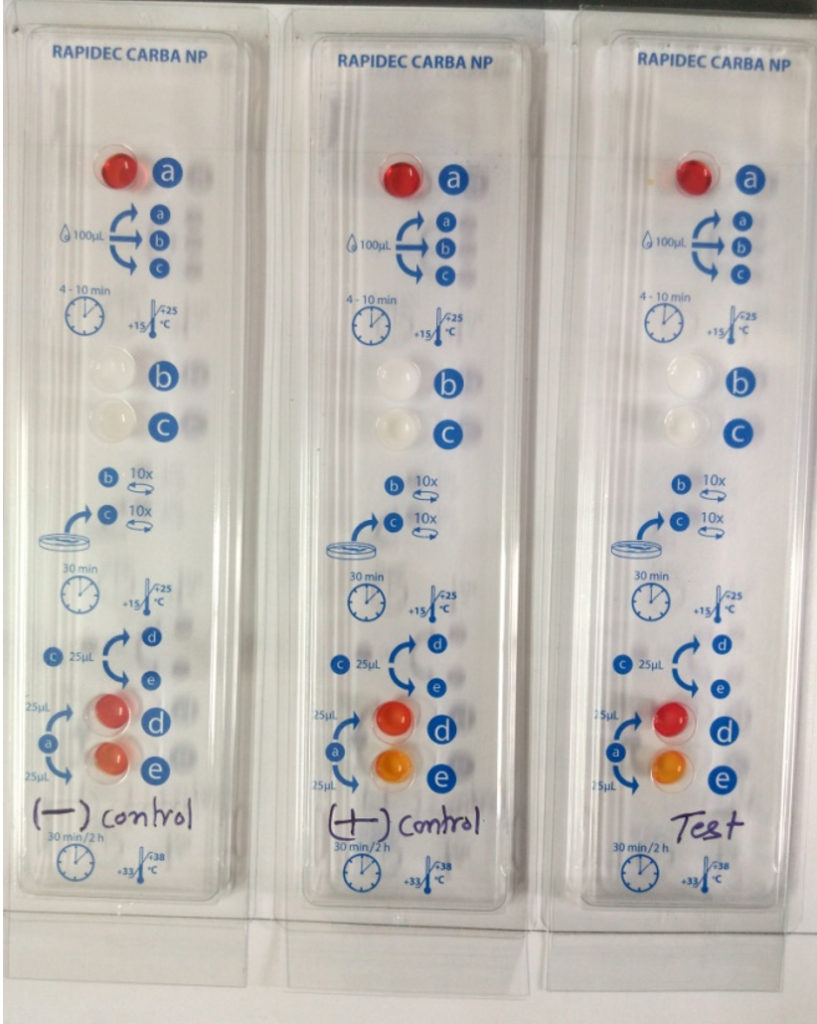 Detection of Carbapenem-resistant Enterobacteriaceae by Real-Time PCR ...