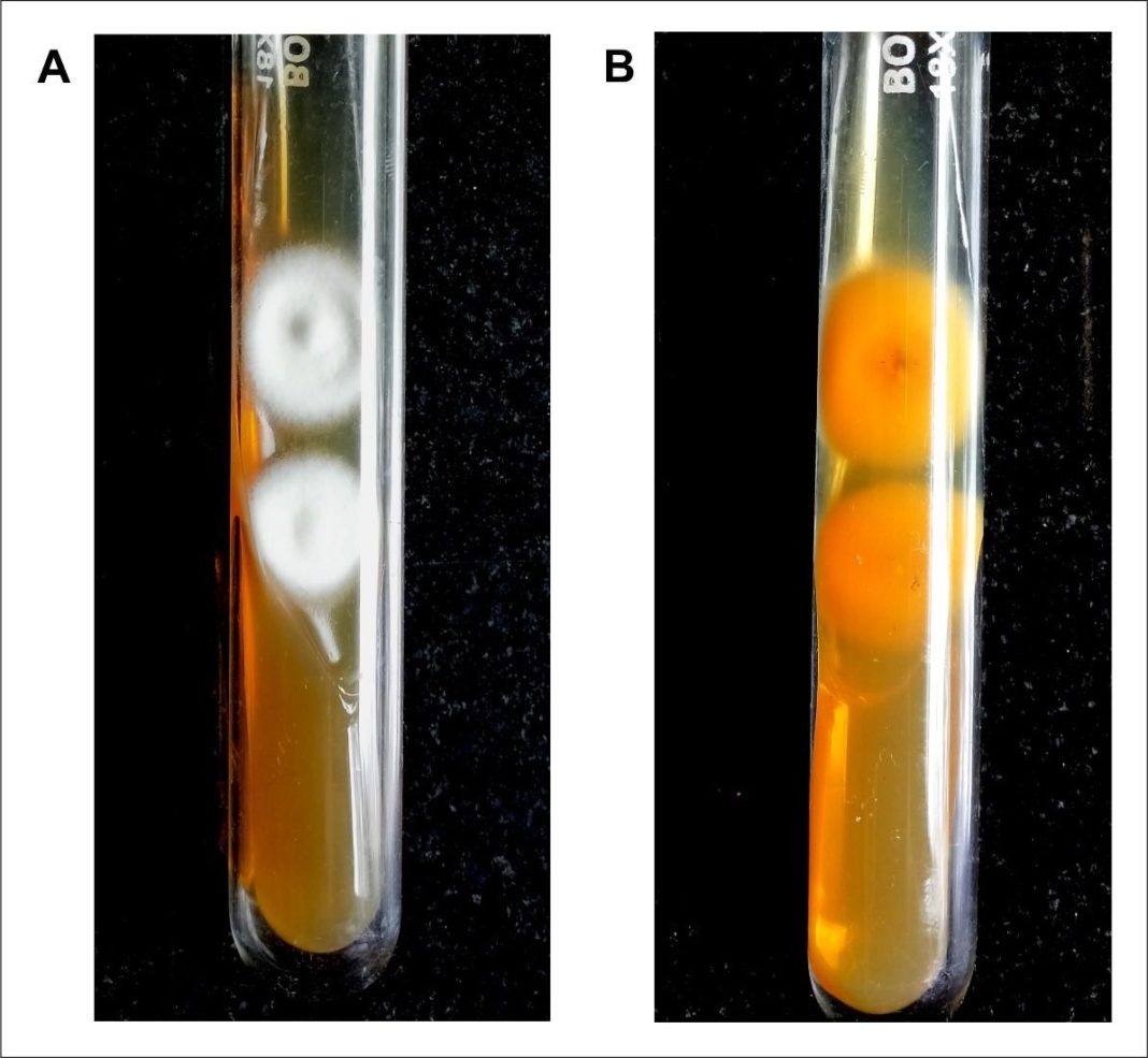 A Comparative Study on the Phenotypic Versus Molecular Identification ...
