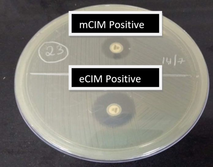 Use of the Combined Modified Carbapenem Inactivation Method and EDTA ...