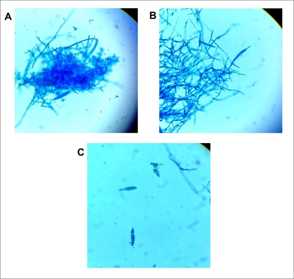 A Comparative Study on the Phenotypic Versus Molecular Identification ...