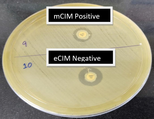 Use of the Combined Modified Carbapenem Inactivation Method and EDTA ...