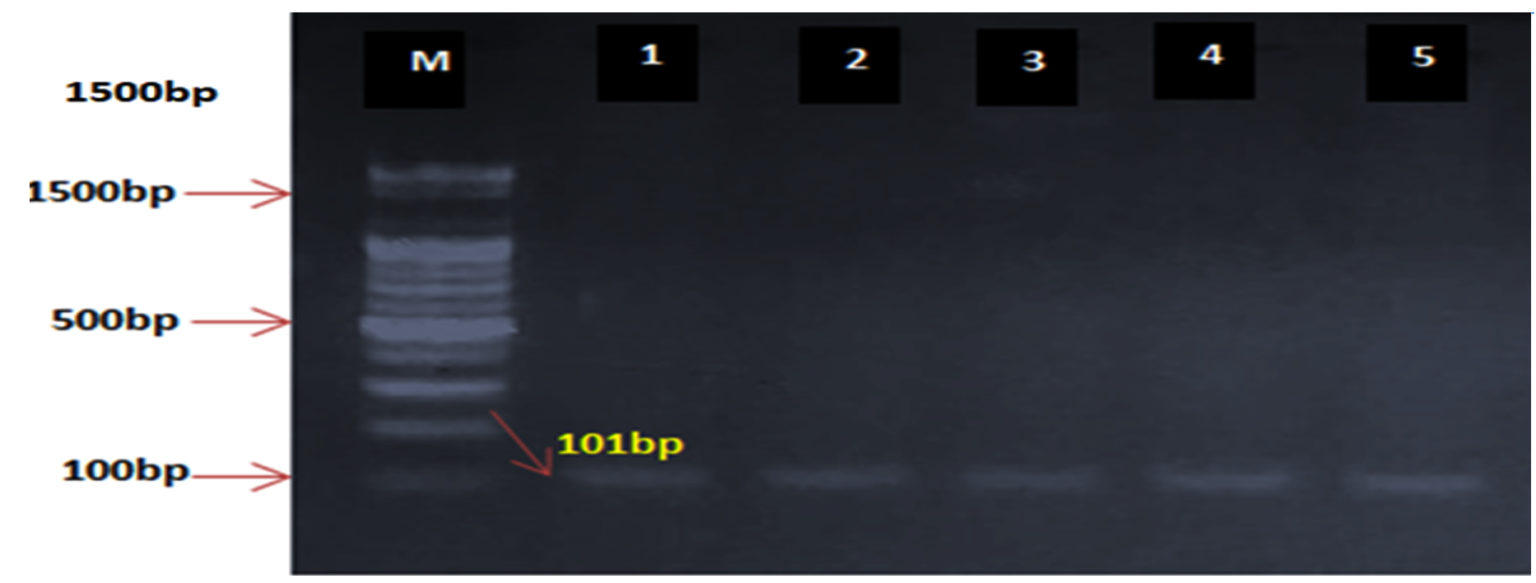 Molecular Study to Detect Escherichia coli in Diarrheic Children and ...