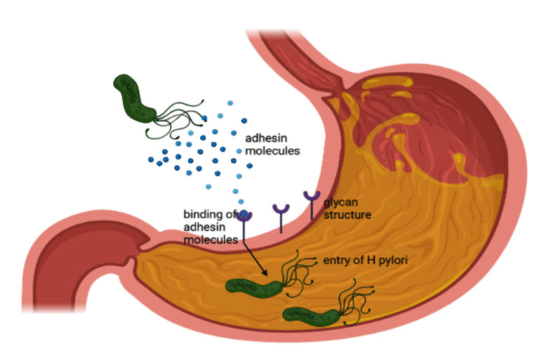 Management of H. pylori Induced Peptic ulcer – A Phytotherapeutic ...