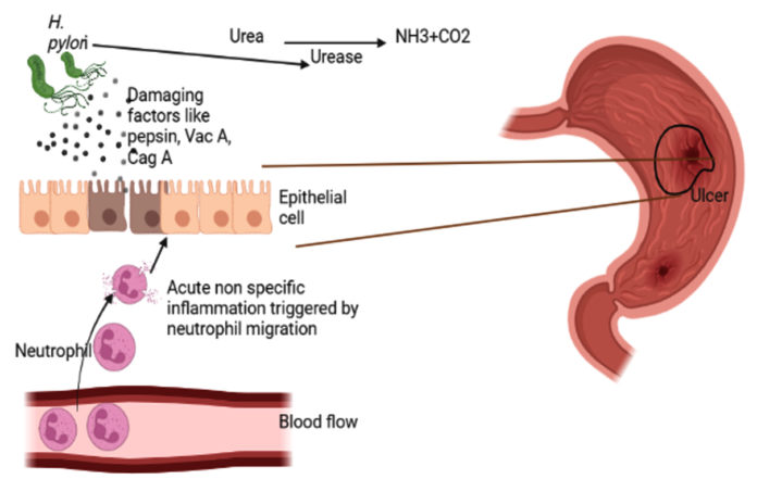 Management of H. pylori Induced Peptic ulcer – A Phytotherapeutic ...