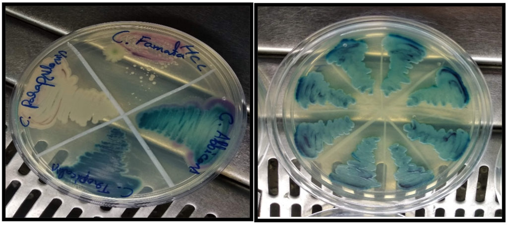 Genotyping of Candida albicans and Comparison of its Antifungal ...