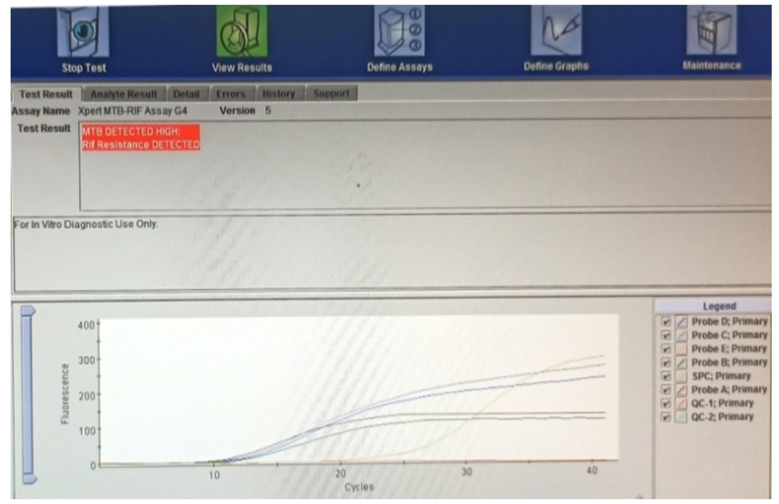 A Comparison Study of CBNAAT, Gene Xpert and Line Probe Assays in the ...