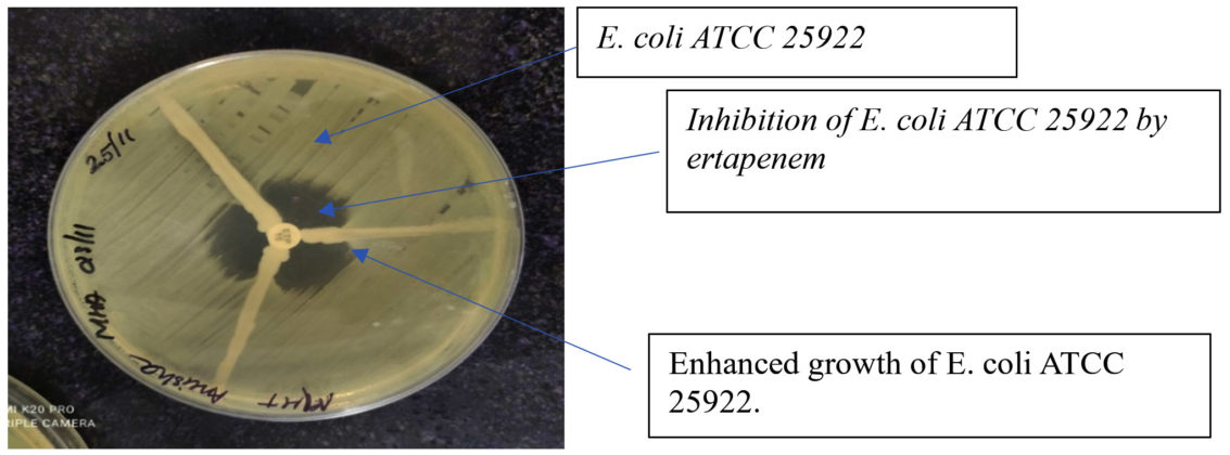 Comparison of Three Phenotypic Methods of Carbapenemase Enzyme ...