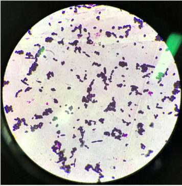 Monitoring the Spectrum of Candidemia and its Anti-fungal Resistance in ...