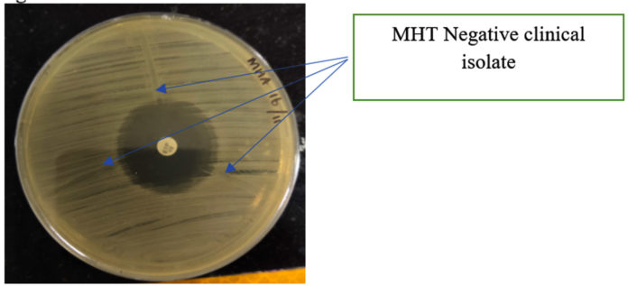 Comparison of Three Phenotypic Methods of Carbapenemase Enzyme ...