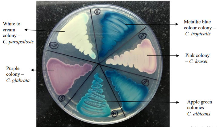 Monitoring the Spectrum of Candidemia and its Anti-fungal Resistance in ...