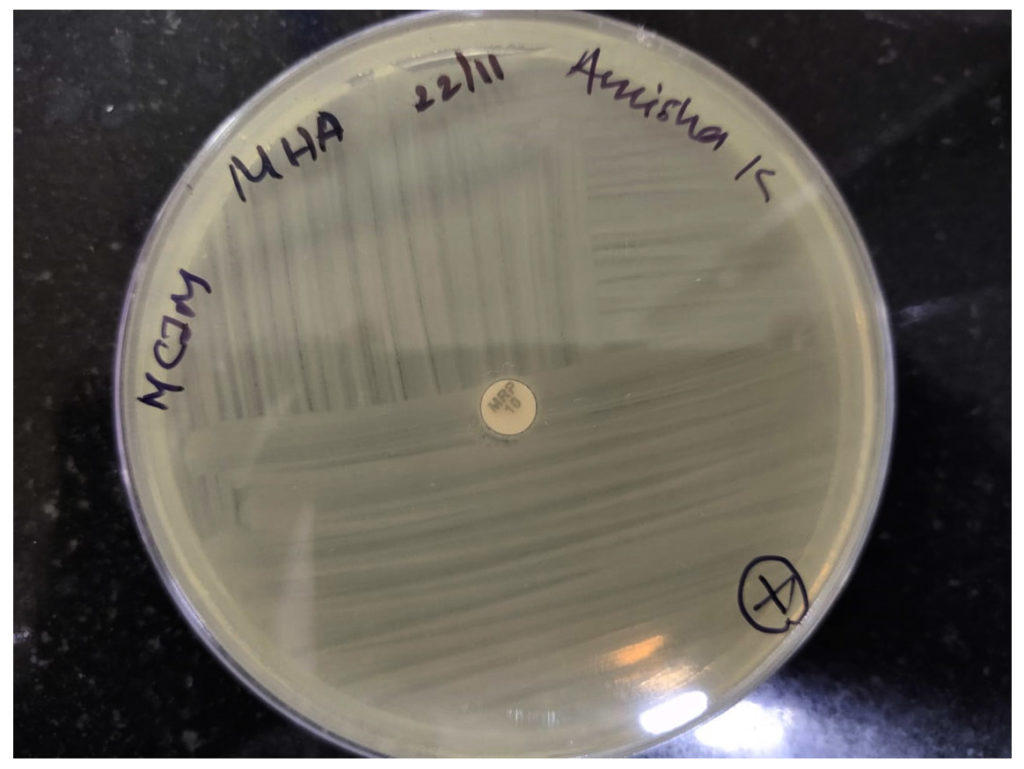 Comparison of Three Phenotypic Methods of Carbapenemase Enzyme ...