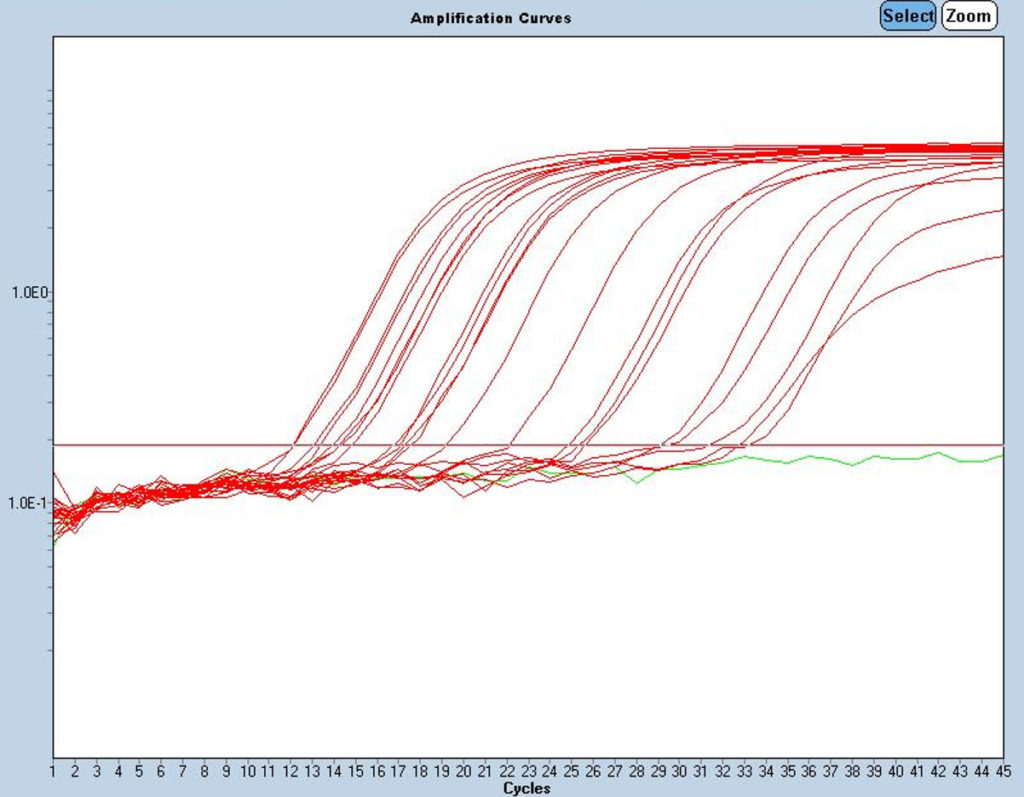 Detection of the SARS-CoV-2 Omicron Variant in COVID-19 Patients from ...