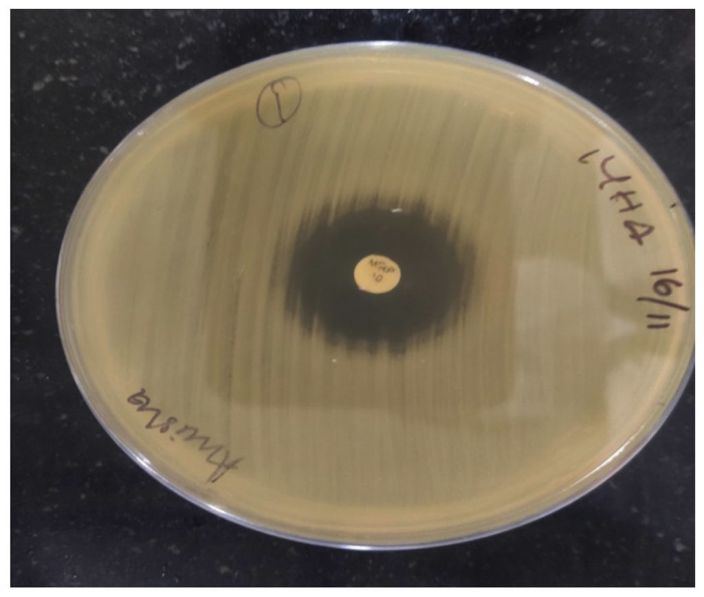 Comparison Of Three Phenotypic Methods Of Carbapenemase Enzyme Detection To Identify Carbapenem