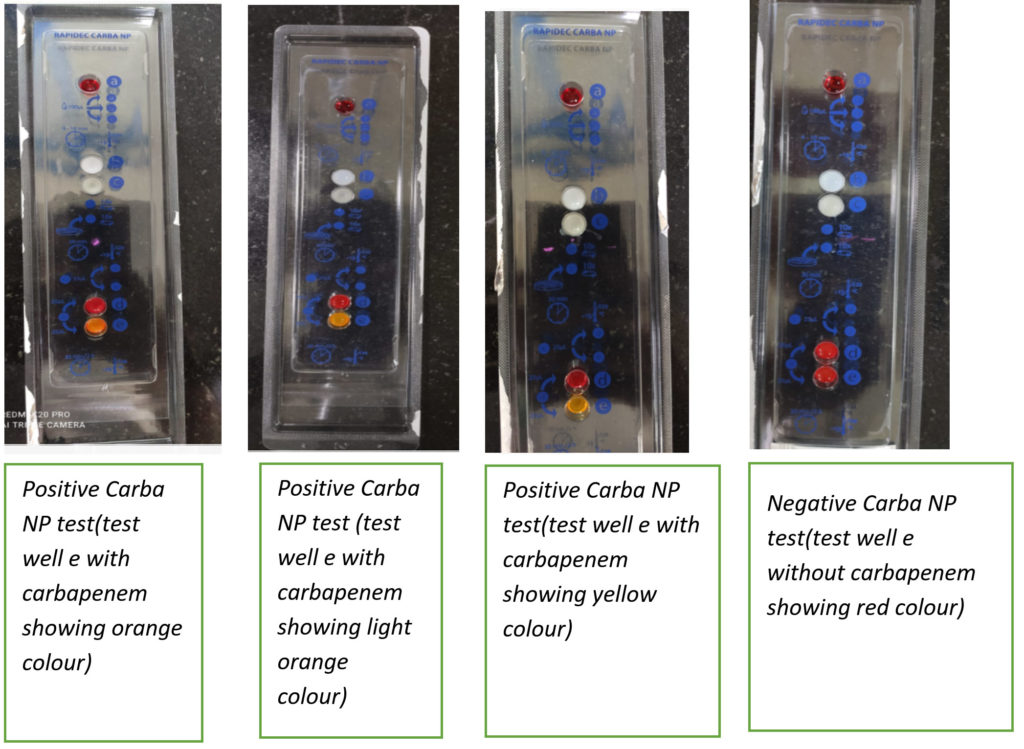 Comparison of Three Phenotypic Methods of Carbapenemase Enzyme ...